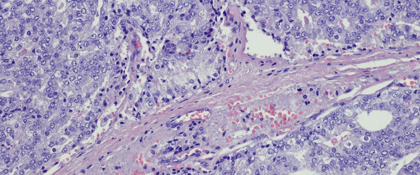 Home: Bonini Lab: Feinberg School of Medicine