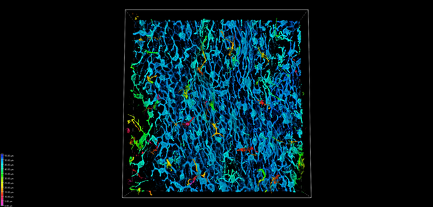 Desmosomes in Cancer: Kathleen J. Green Lab: Feinberg School of Medicine