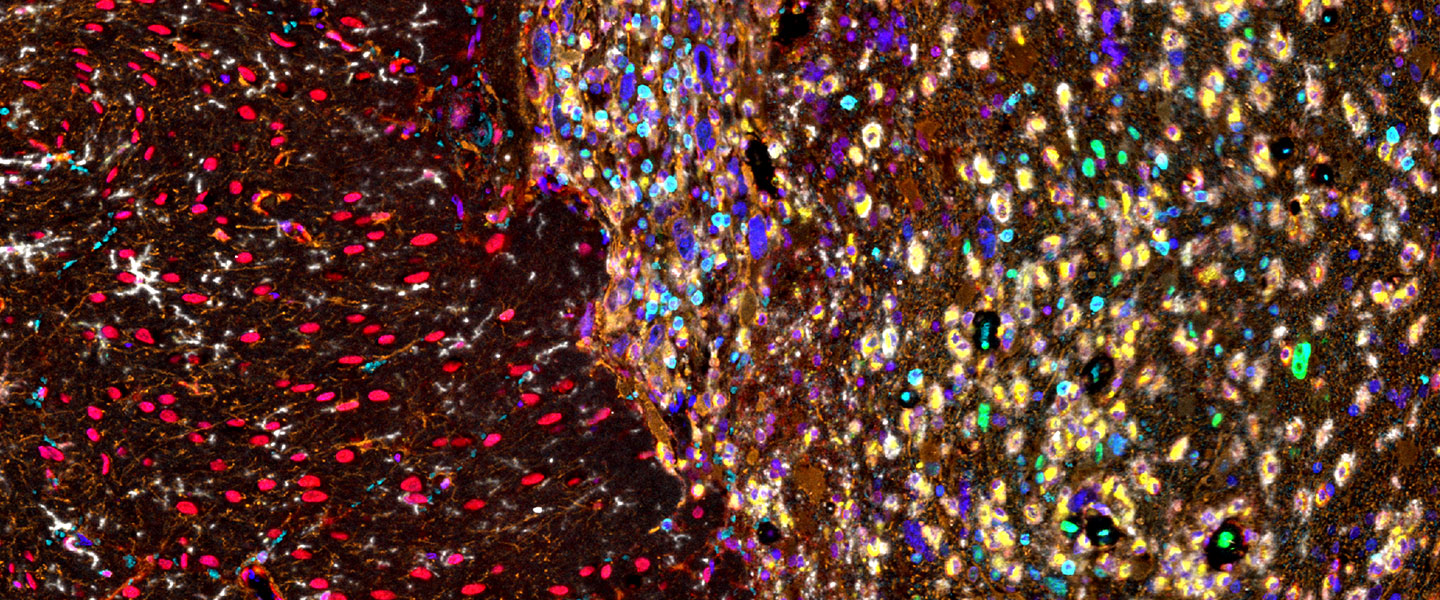 Home: Amy Heimberger Lab: Feinberg School of Medicine