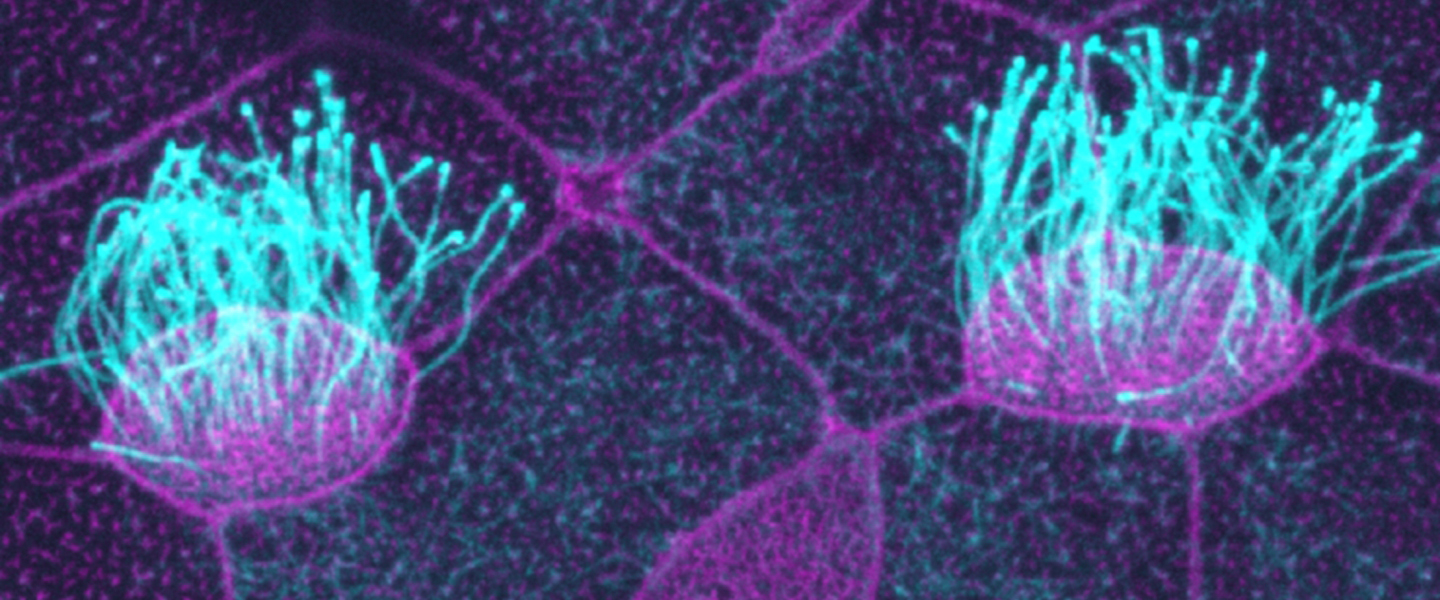 Home: Mitchell Lab: Feinberg School of Medicine