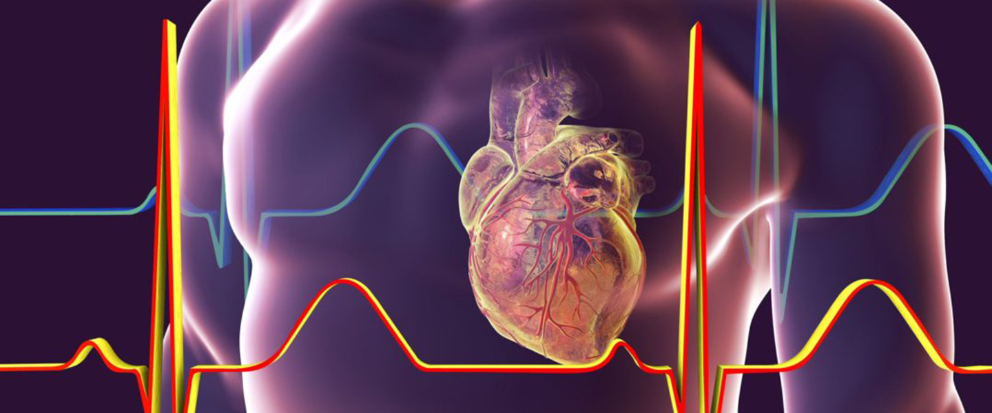 Home: Sanjiv Shah Lab: HFpEF and Cardiac Mechanics: Feinberg School of ...